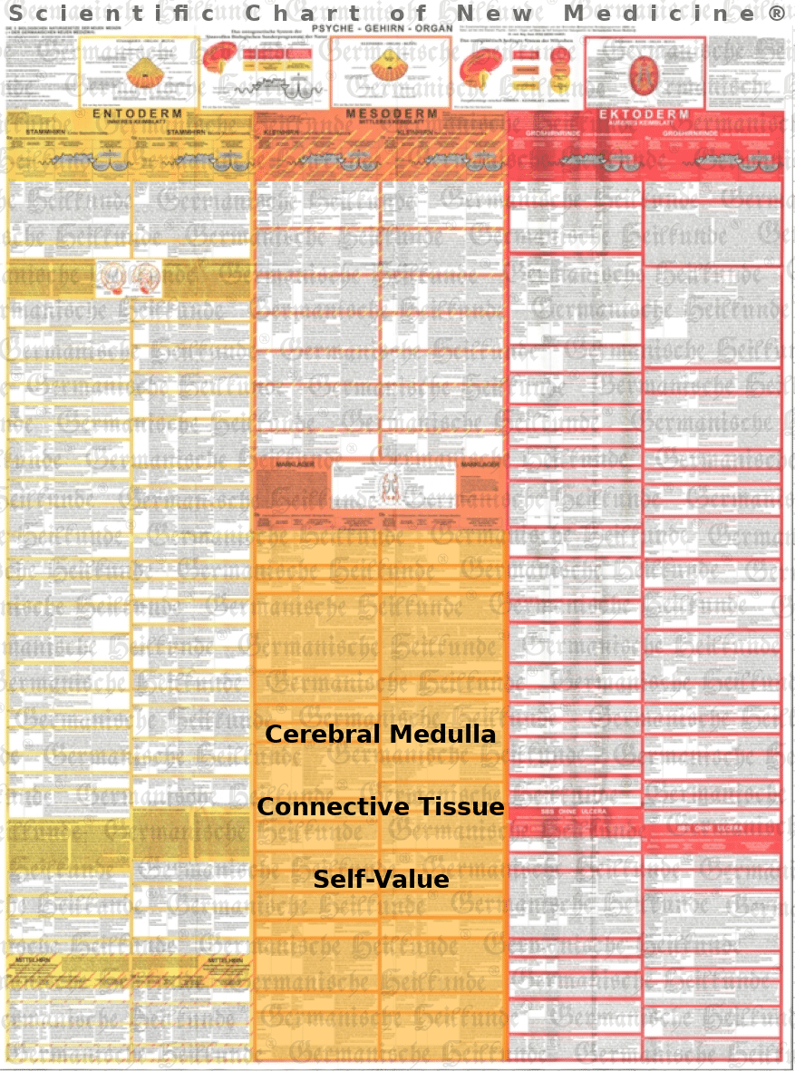 Bone Cancer on the right - Diagnostic Chart - GHK Academy