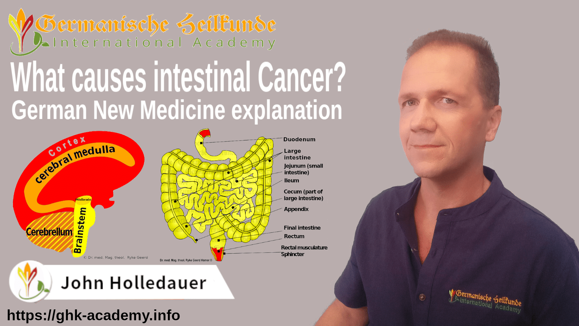What causes intestinal Cancer? - GHK Academy